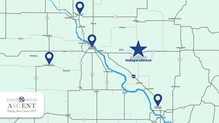Image-Guided SRT • Independence - Cedar Valley ASCENT
